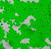 UM-SCC-105 Human Squamous Carcinoma Cell Line | SCC189